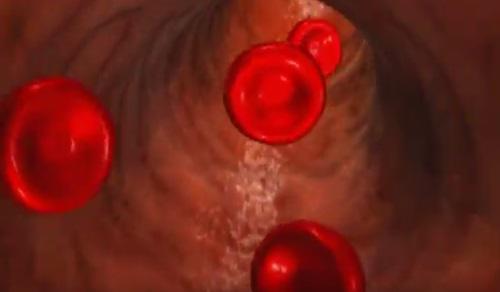 Este posibil sa aveti anemie? 5 lucruri pe care trebuie sa le stiti ...