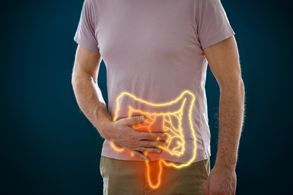 Cancerul colorectal lovește tăcut. Conf. Dr. Vasile Bintințan, medic ...